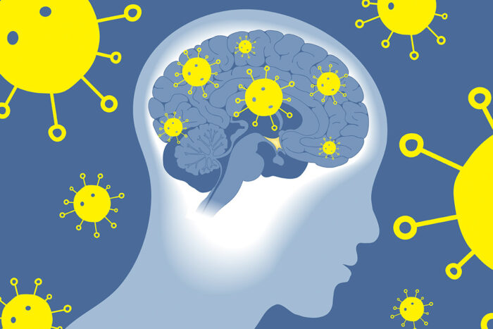 COVID-19 infections increase risk of long-term brain problems - John T ...